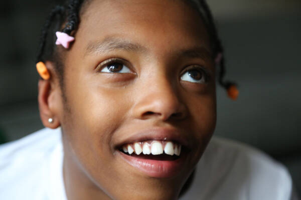 Chromosome 5P-, Cri Du Chat Syndrome - Positive Exposure