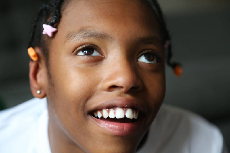 Chromosome 5P-, Cri Du Chat Syndrome - Positive Exposure