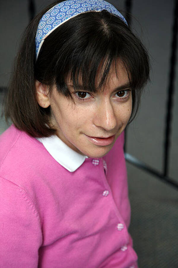Prader-willi syndrome - Positive Exposure