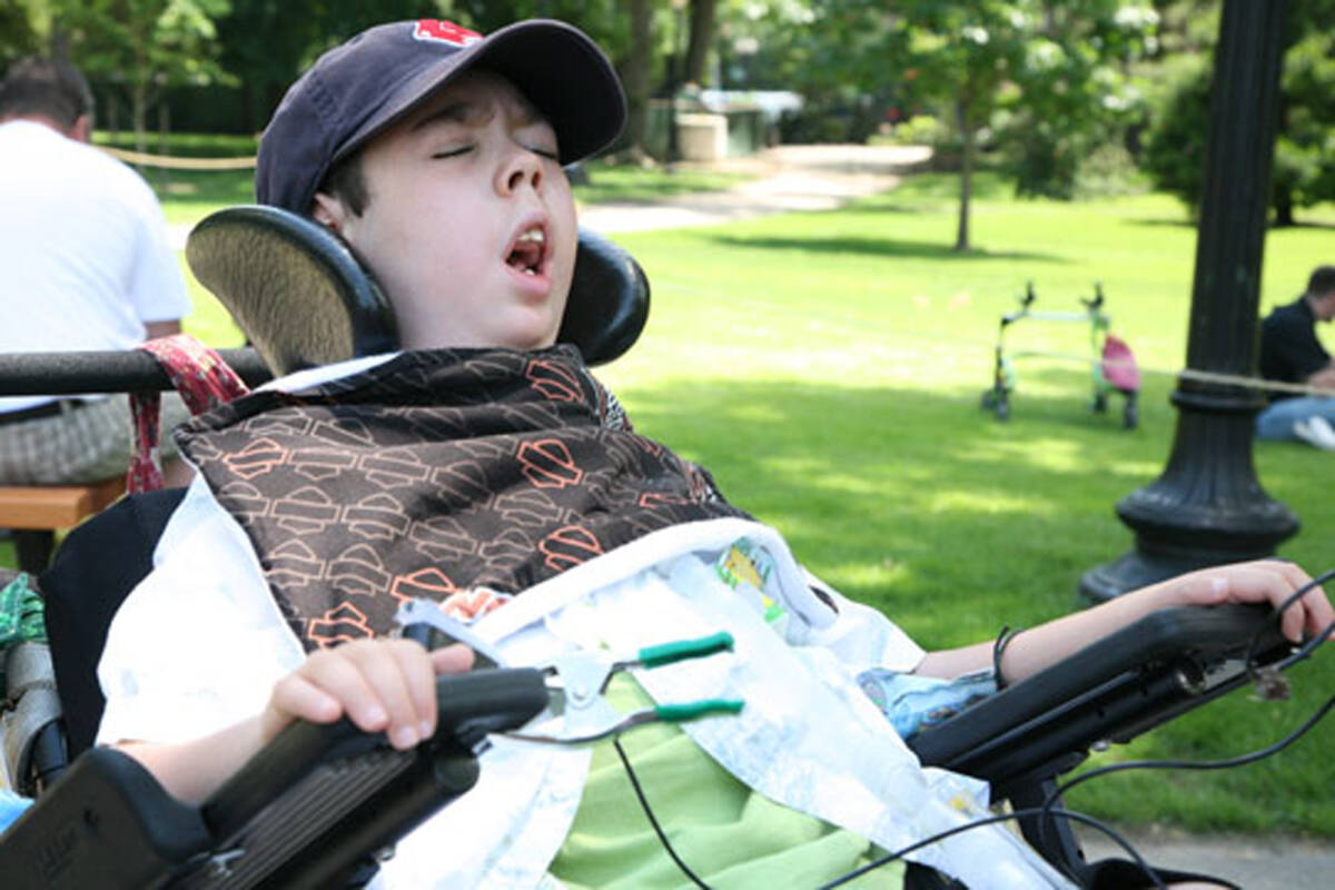 Spinal Muscular Atrophy - Positive Exposure