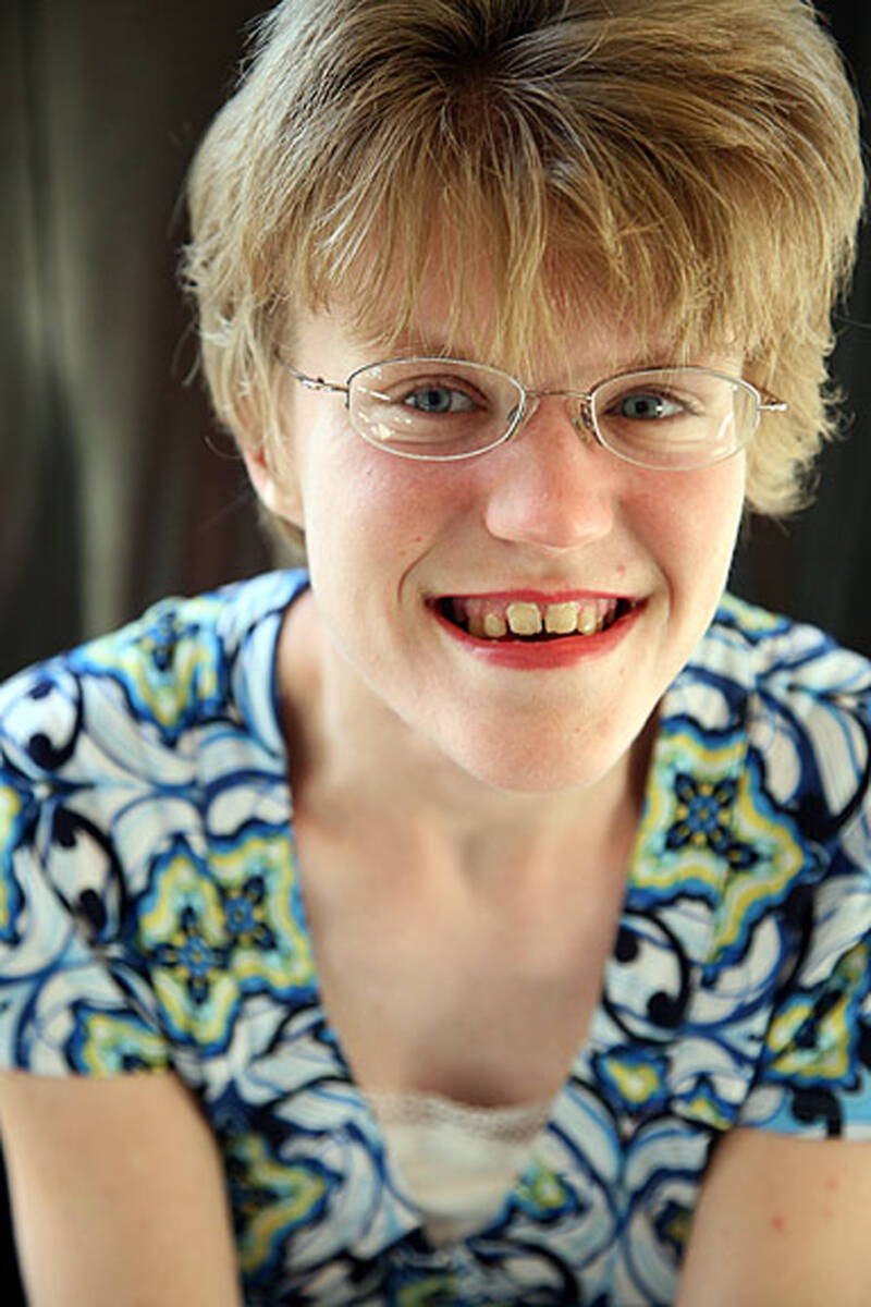 Smith-Magenis Syndrome - Positive Exposure