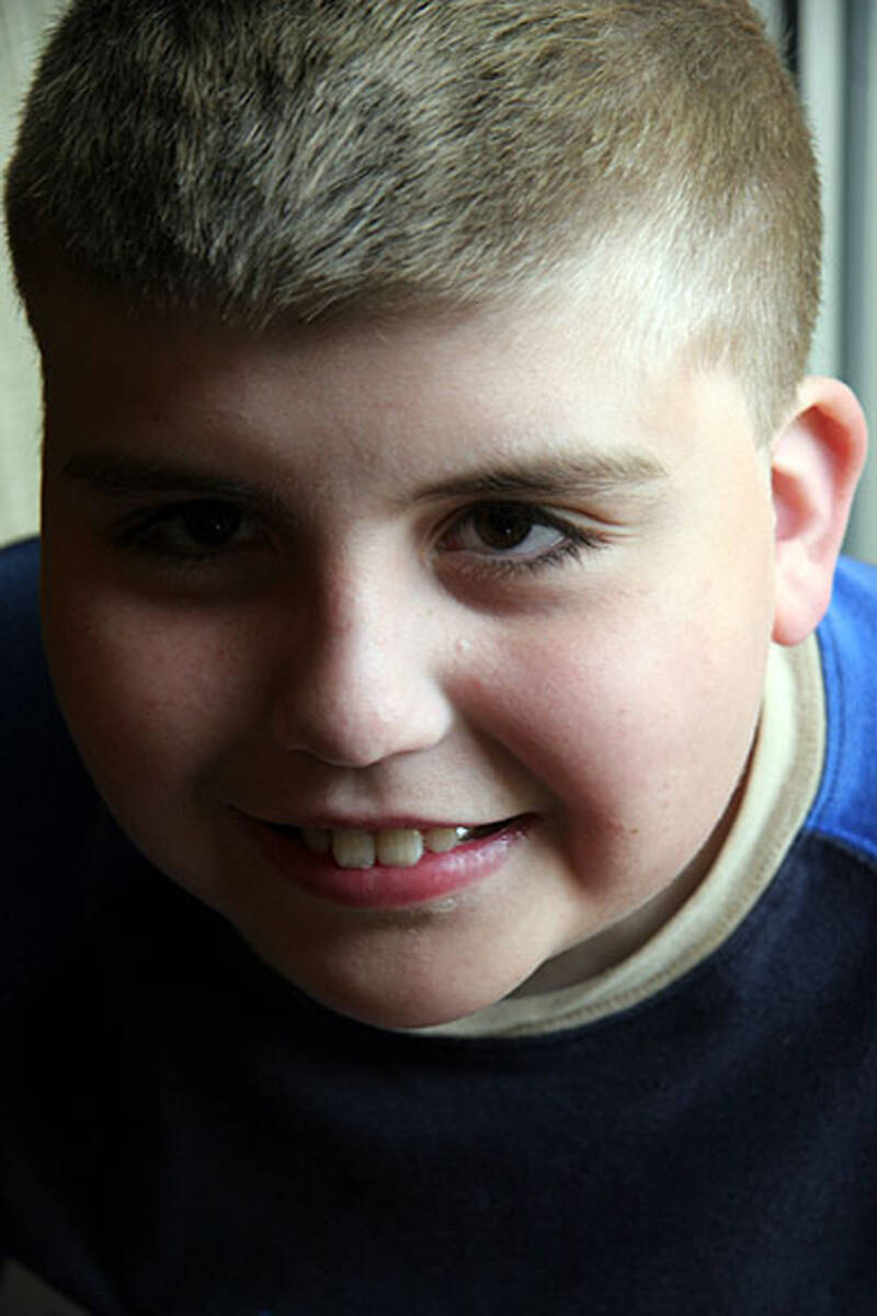 Smith-Magenis Syndrome - Positive Exposure