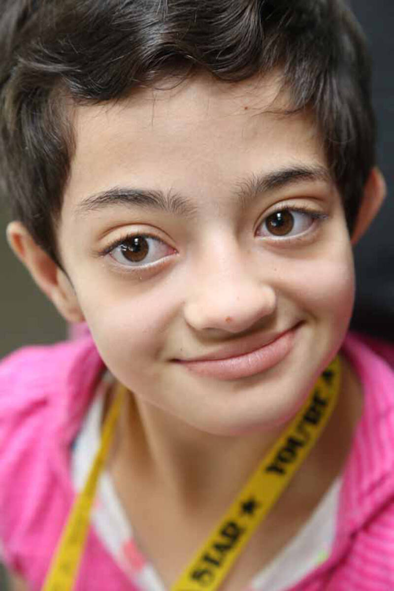 Chromosome 4P-, Wolf–Hirschhorn Syndrome - Positive Exposure