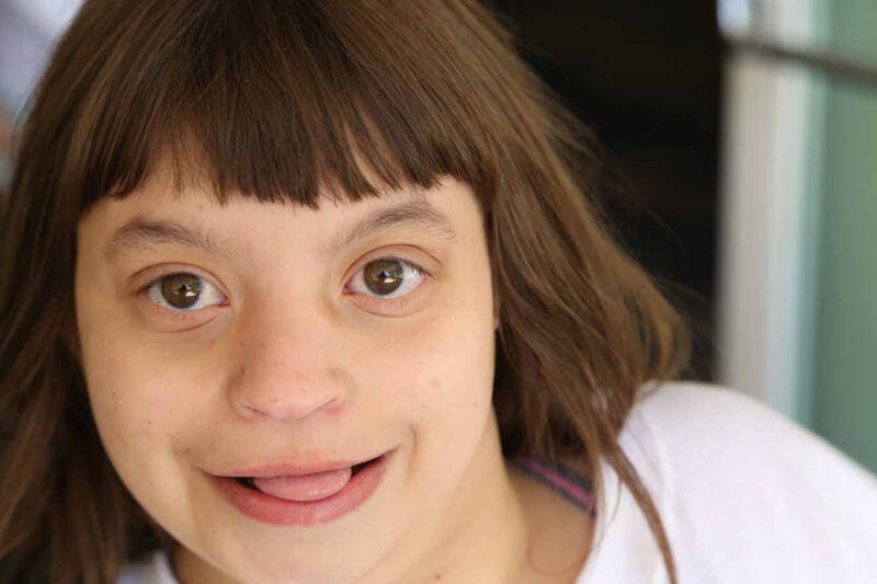 Chromosome 4P-, Wolf–Hirschhorn Syndrome - Positive Exposure