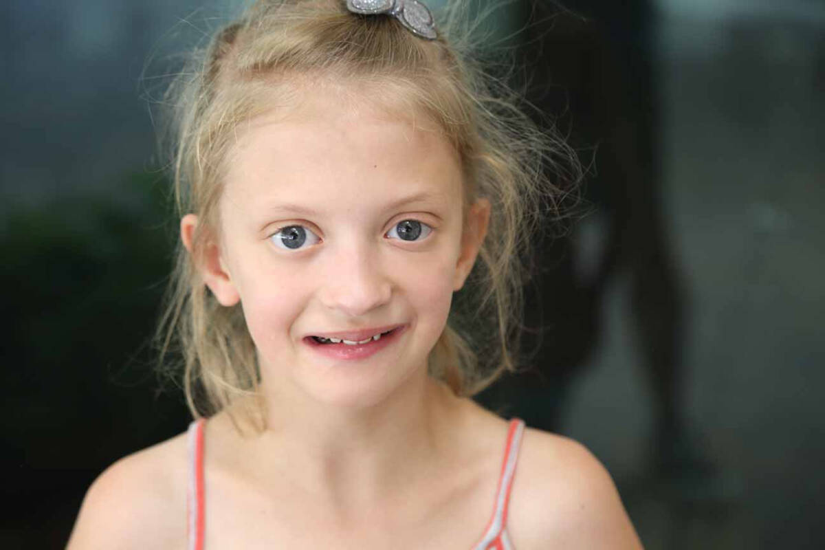 Chromosome 4P-, Wolf–Hirschhorn Syndrome - Positive Exposure