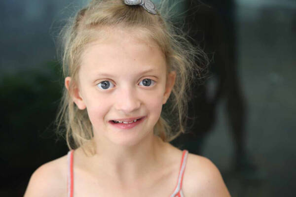 Chromosome 4P-, Wolf–Hirschhorn Syndrome - Positive Exposure