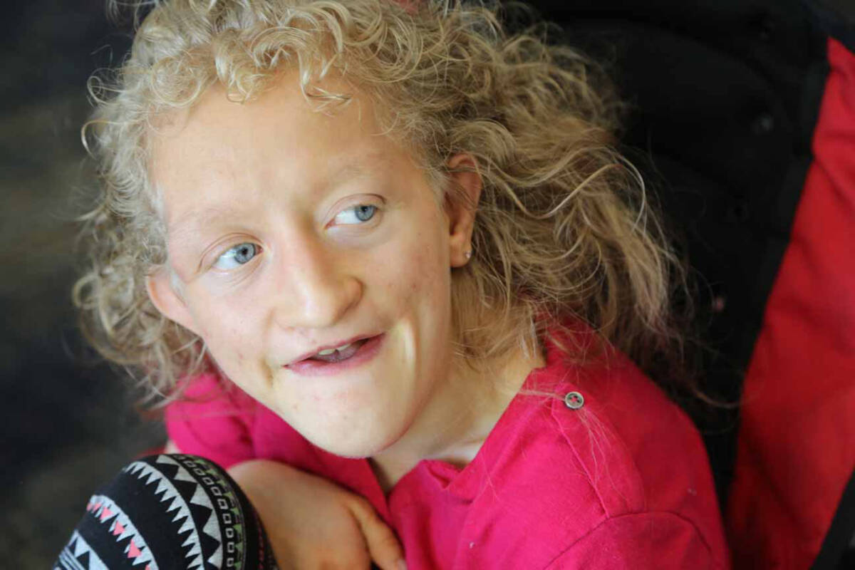 Chromosome 4P-, Wolf–Hirschhorn Syndrome - Positive Exposure