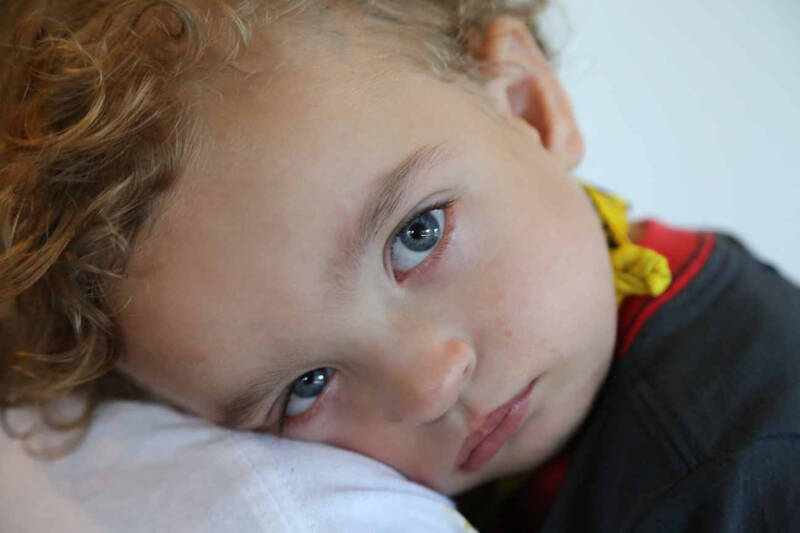 Chromosome 4P-, Wolf–Hirschhorn Syndrome - Positive Exposure