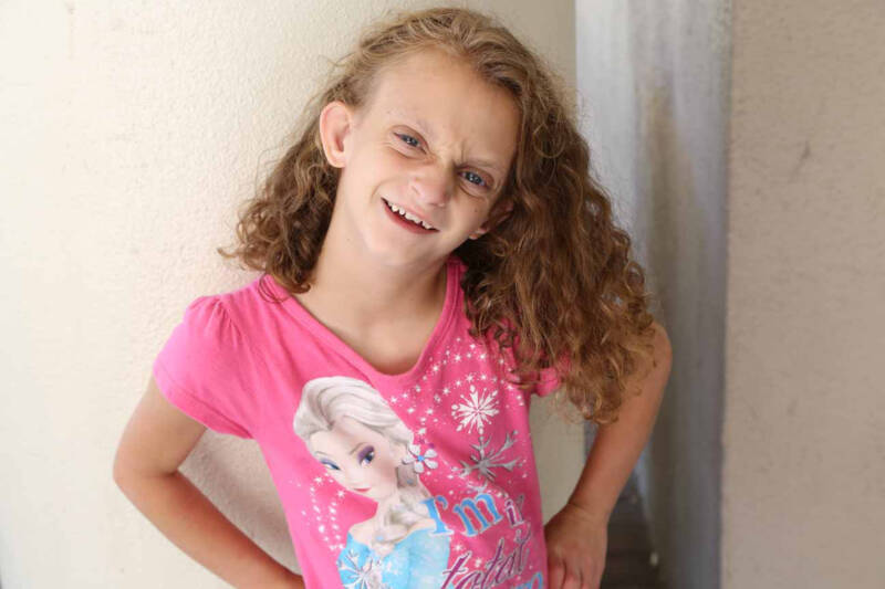 Chromosome 4P-, Wolf–Hirschhorn Syndrome - Positive Exposure