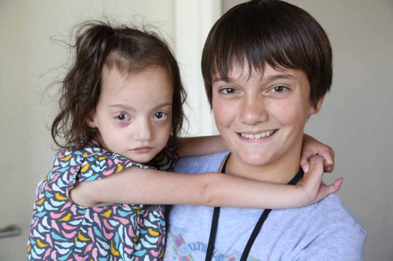 Chromosome 4P-, Wolf–Hirschhorn Syndrome - Positive Exposure