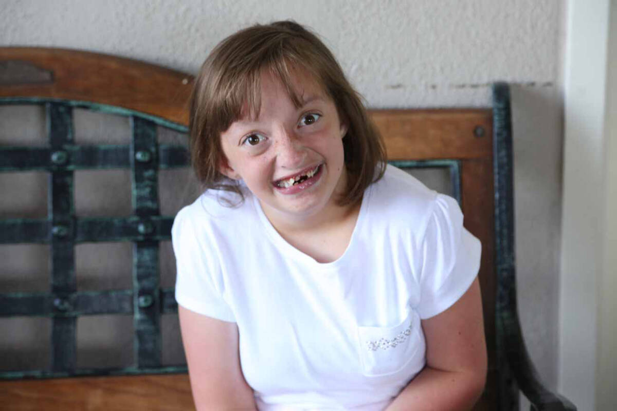 Chromosome 4P-, Wolf–Hirschhorn Syndrome - Positive Exposure