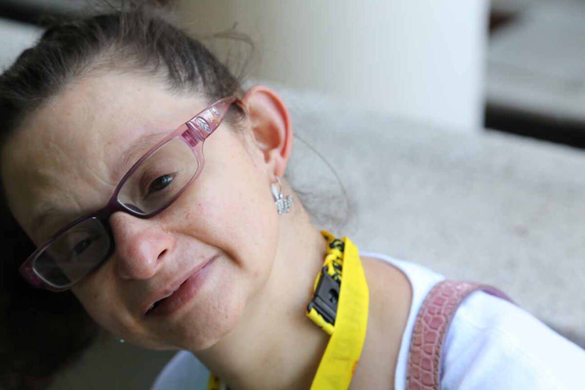Chromosome 4P-, Wolf–Hirschhorn Syndrome - Positive Exposure