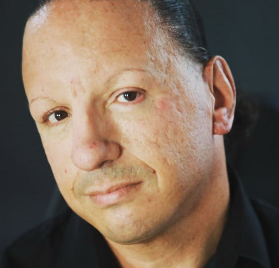 Giuseppe (Joe) - Positive Exposure